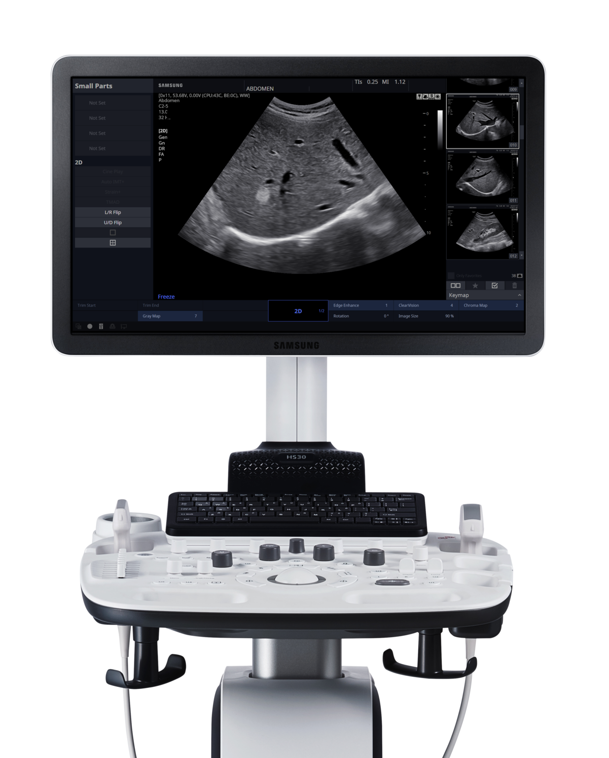 Échographe Samsung HS30 - Échographe Imagerie Générale