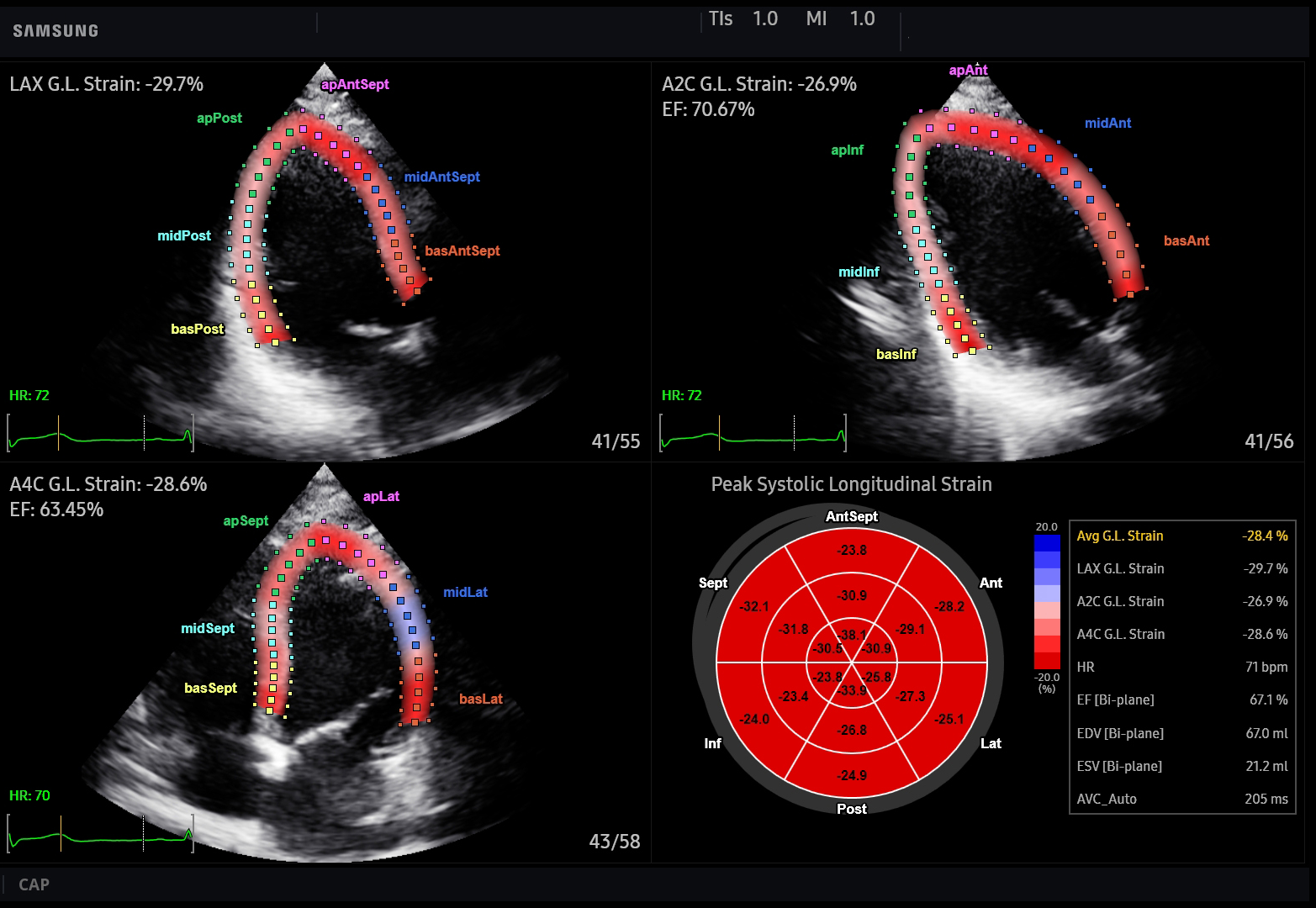 Échographe Samsung HS50 - Échographie Obstétrique/Gyn