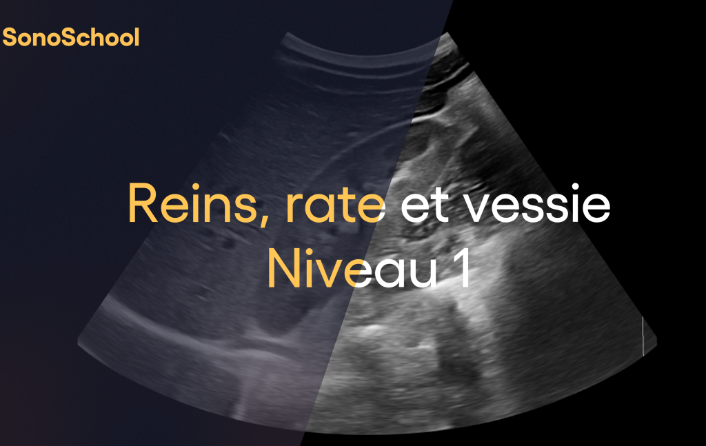 Formation échographie - iSonic Sonoschool