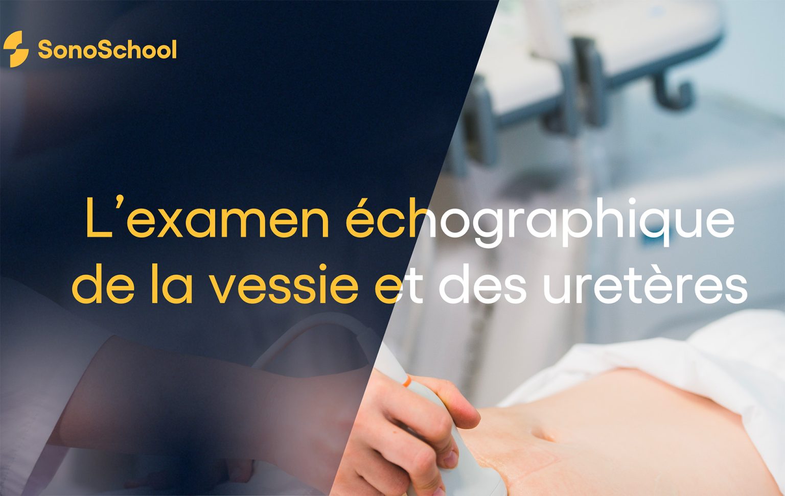 Formation échographie de la vessie | Sonoschool
