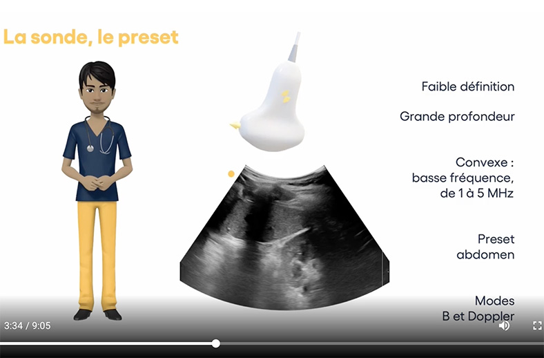 Comment faire une échographie de la rate | Sonoschool