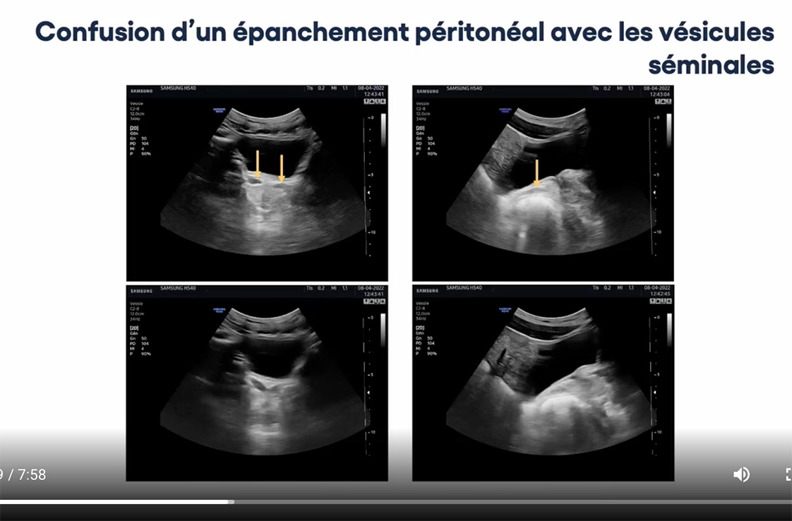Pathologies Fast Echo | Sonoschool