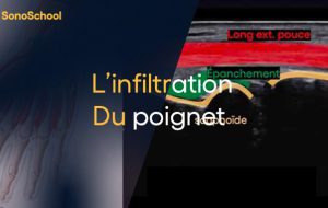 Infiltration sous échographie | Sonoschool x Jimmy Gross